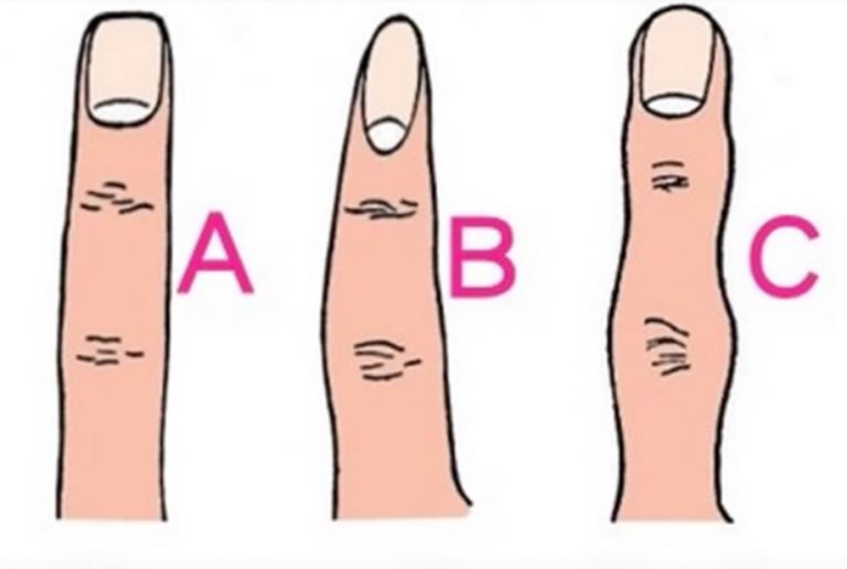 ¿Qué forma tienen tus dedos? Esto es lo que dicen acerca de tu ...